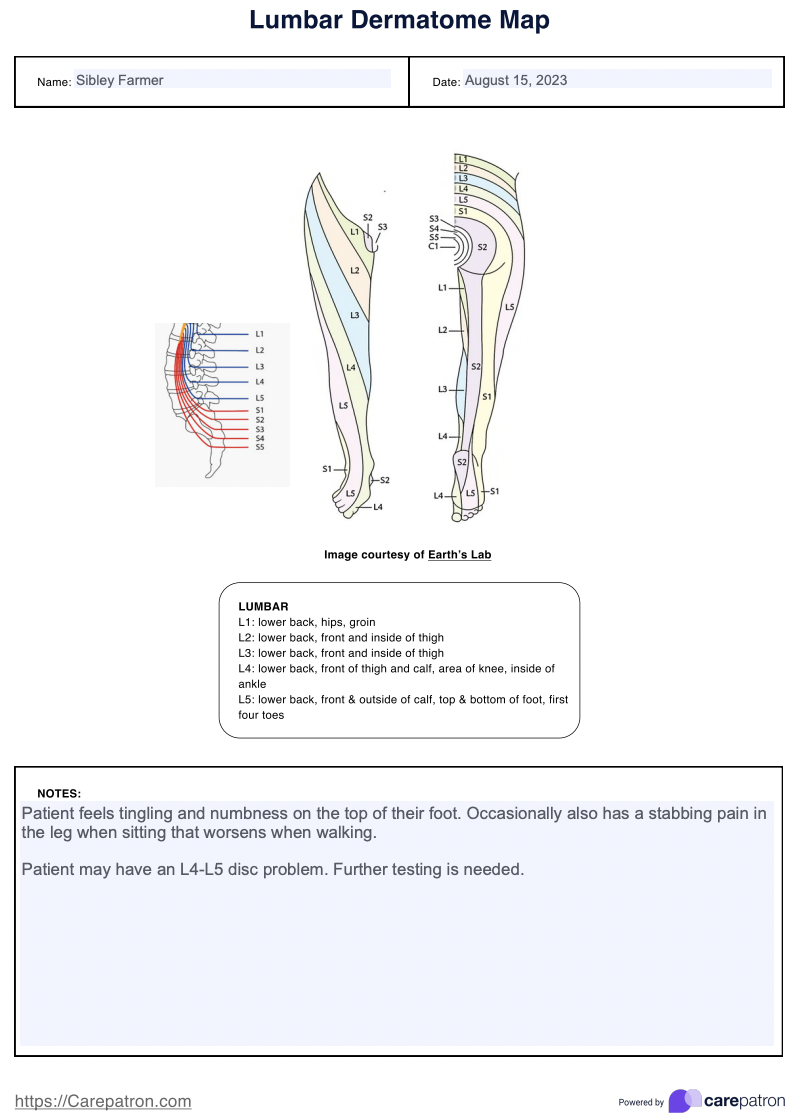 Lower Limb Dermatome Map